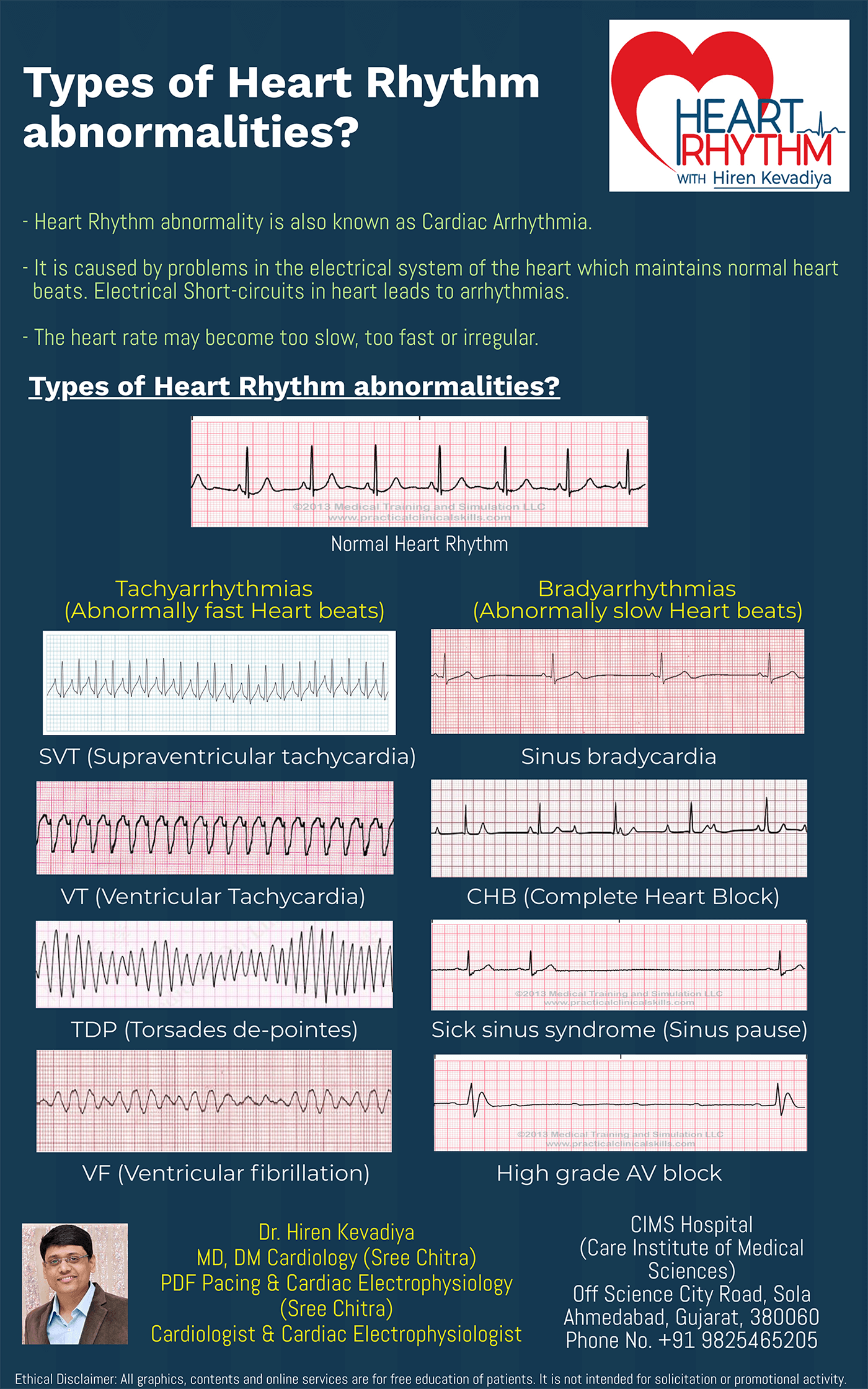 Heart Rhythm By Hiren Kevadiya